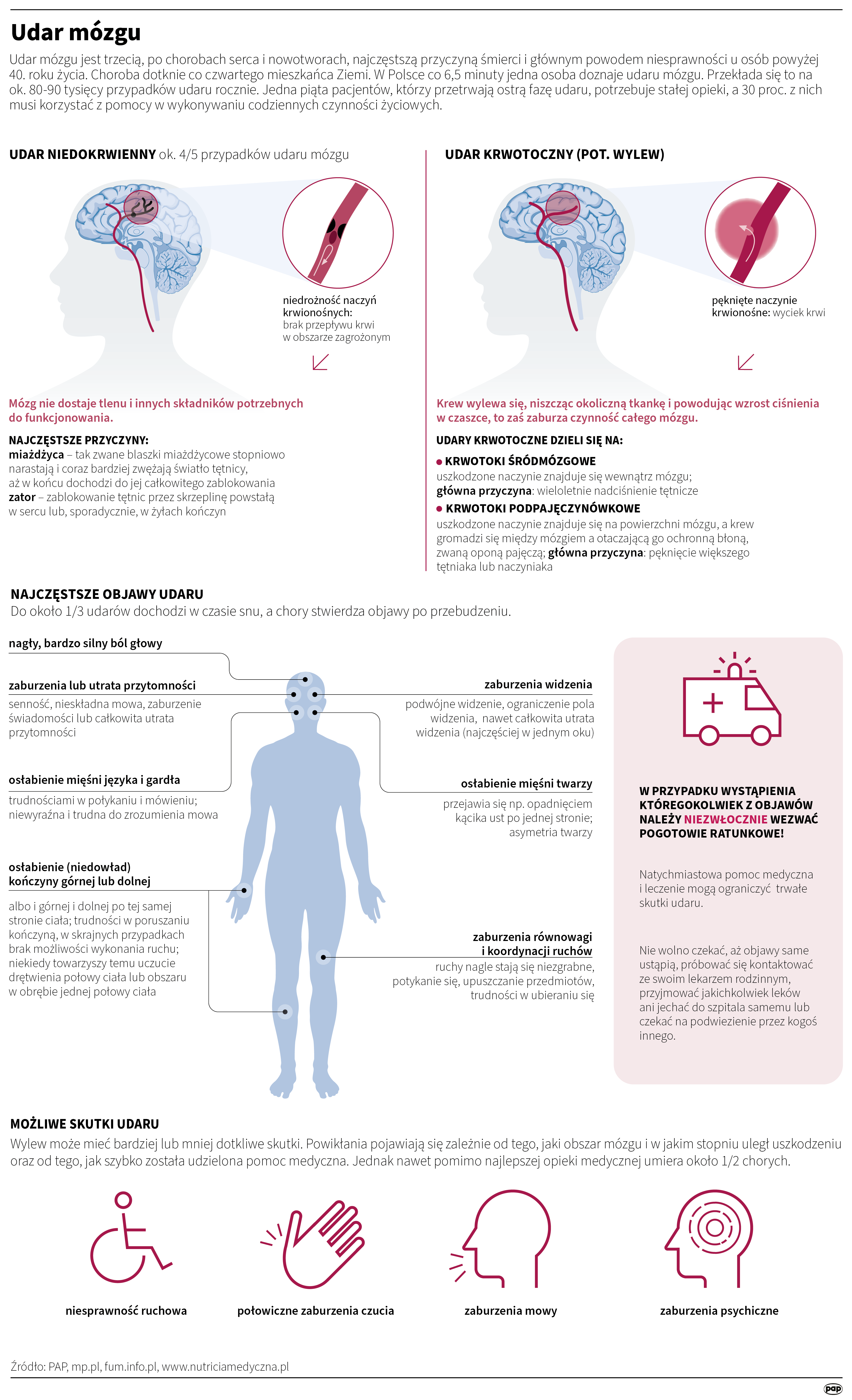 Eksperci: nadciśnienie tętnicze odpowiada za ponad połowę udarów mózgu ...